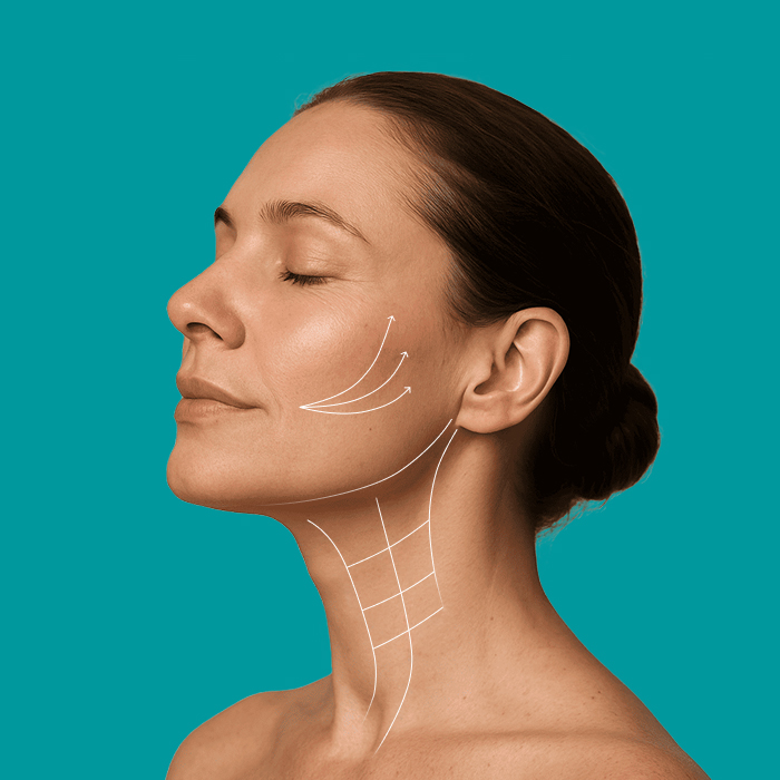 Монополярный RF-лифтинг BTL Exilis Ultra 360 в Ростове-на-Дону